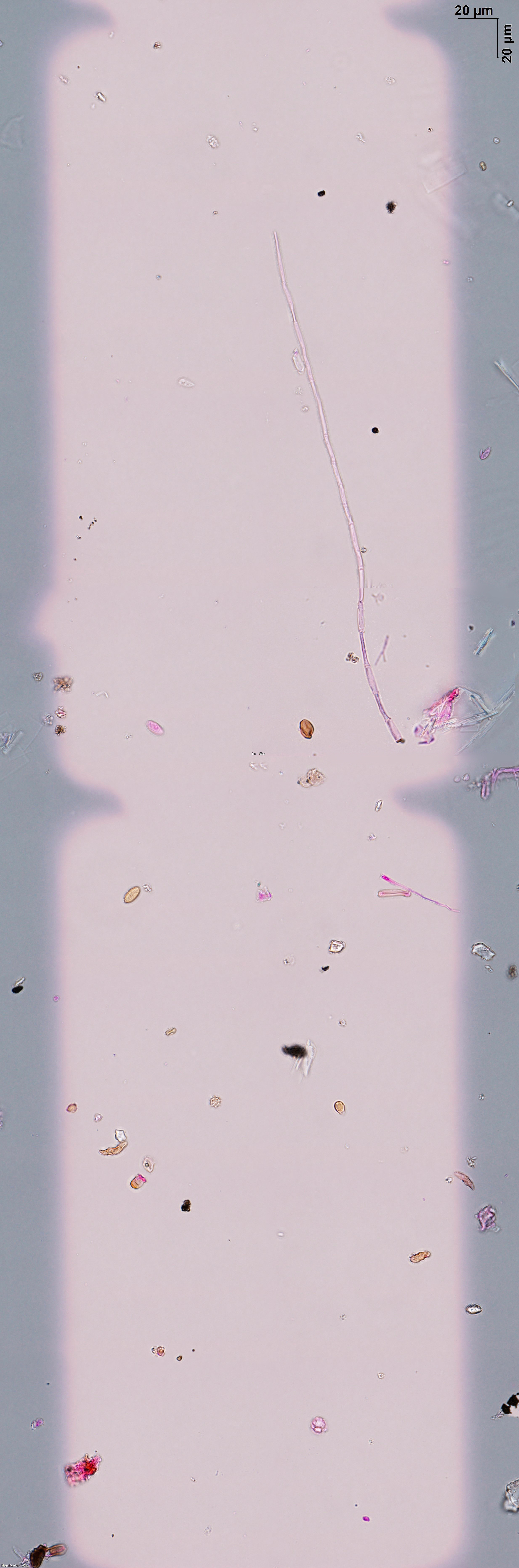 AIHA PAT Programs | EMPAT Total Spore Count Pilot Study